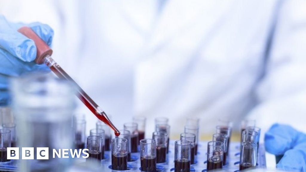 Covid-19: Deeside laboratory for 10,000 daily tests to open - BBC News