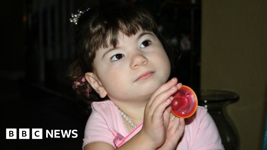 Microcephaly: 'It's not the end of the world' - BBC News