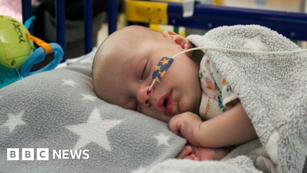 Sheffield Children's Hospital: Baby 'doing OK' after SMA drug first