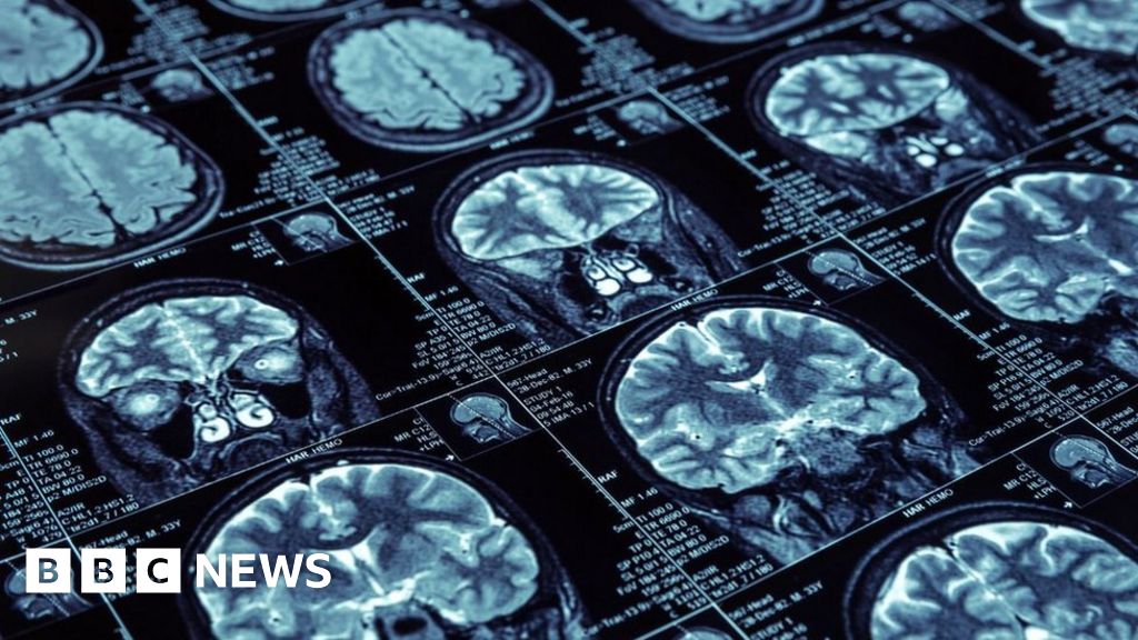 Wales' radiology services 'well-managed but unsustainable' - BBC News