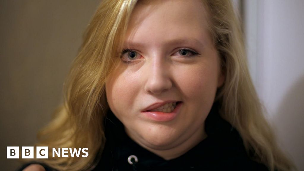 The children living with facial disfigurements - BBC News