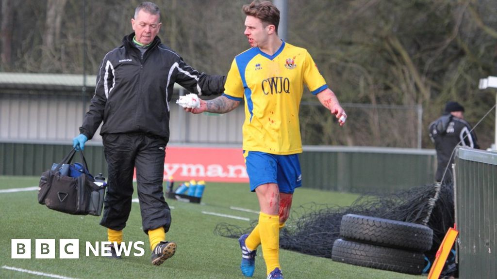 Redbridge's William Drake fined over AFC Sudbury match assault - BBC News