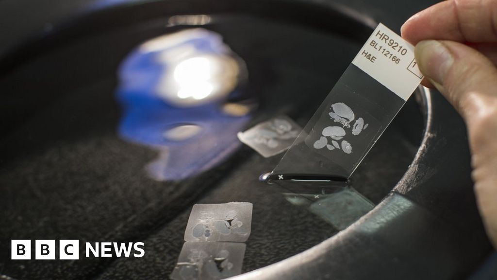 Cancer Research UK invests £190m for 'vital infrastructure' - BBC News