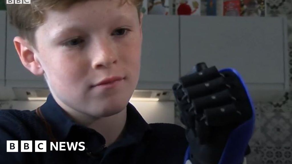 Jacob Pickering gets bionic arm for Christmas - BBC News