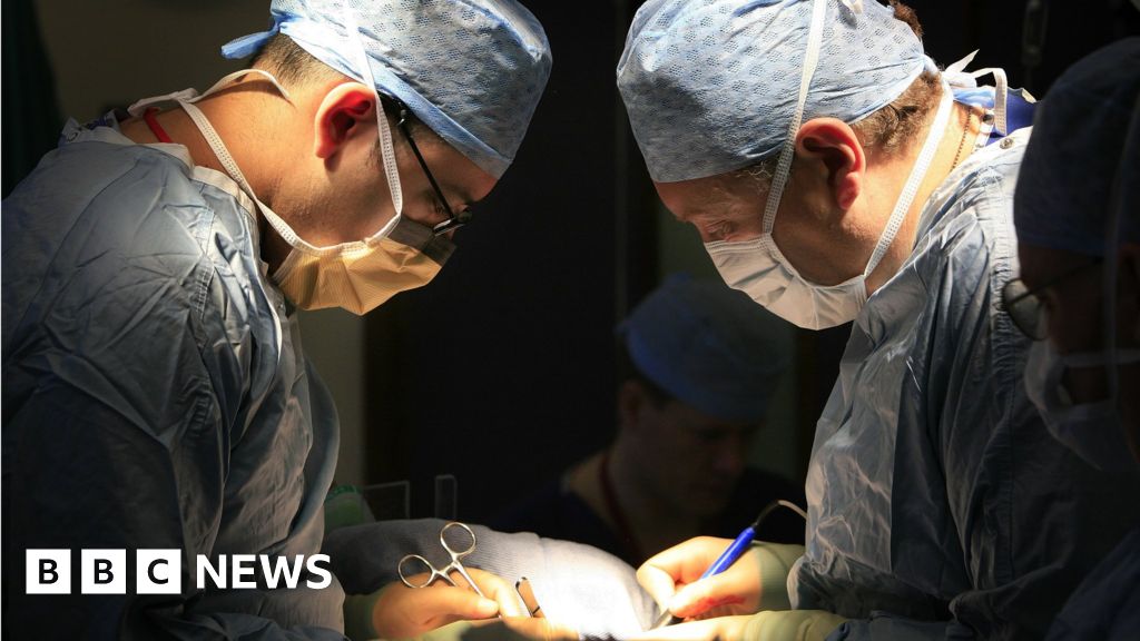 Organ donation: Does an opt-out system increase transplants?