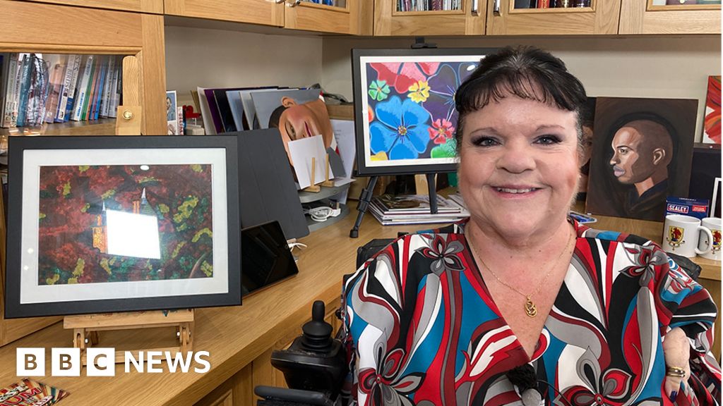 Thalidomide survivor in Wales welcomes lifelong support offer