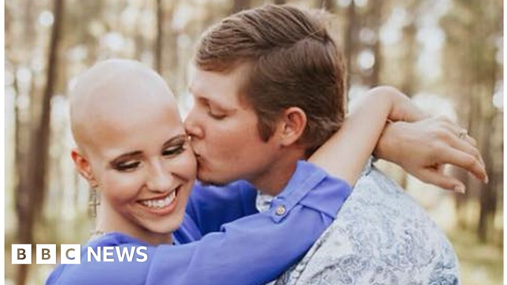 'Beauty shines' as woman bares alopecia in engagement photos - BBC News
