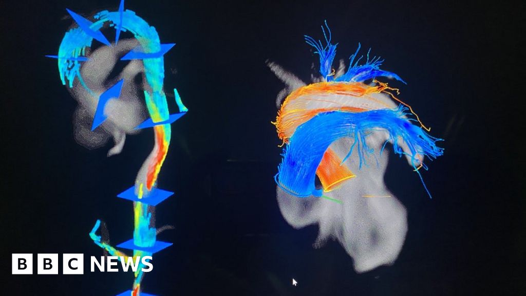 Norwich 4D heart scan 'first for UK hospital'