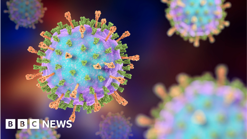 Sharp rise in mumps cases in Northern Ireland