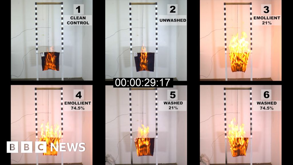 Fire tests show dangers of paraffin based creams soaked into fabric ...