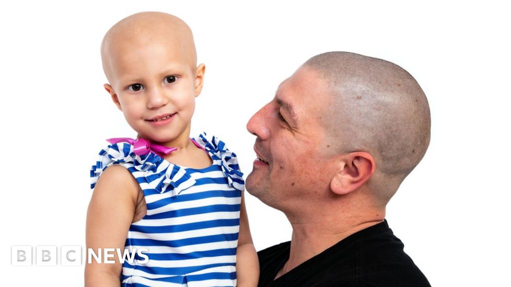 Swaffham dad gets daughter's brain surgery scar tattoo - BBC News