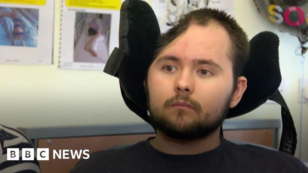 Attack victim: 'I wouldn't wish this on anybody' - BBC News