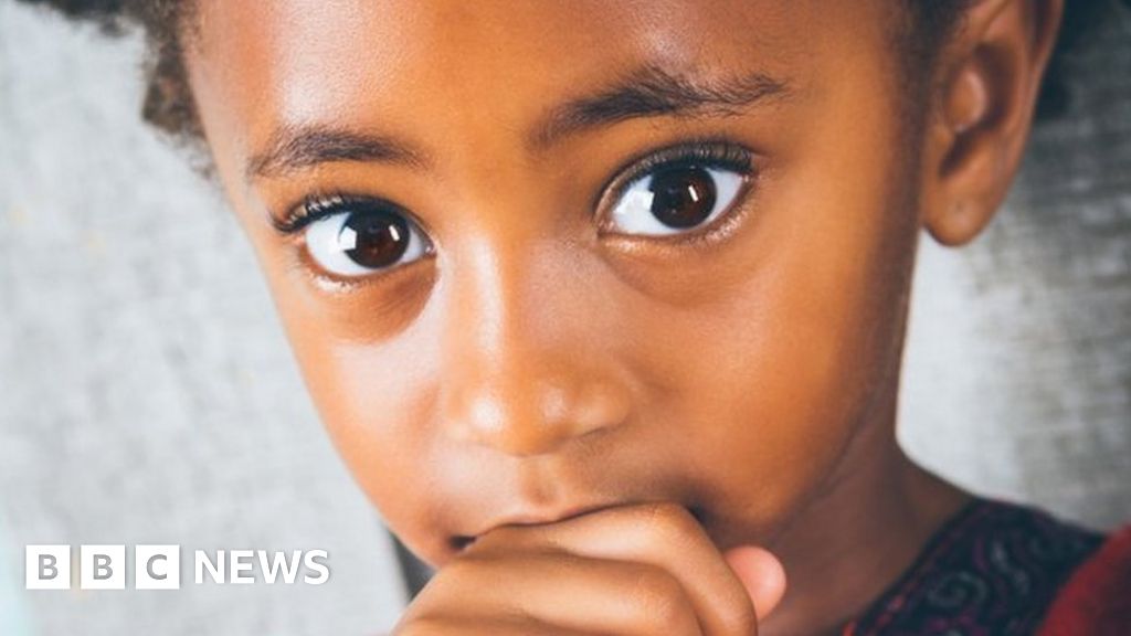 FGM victims need medical attention 'every hour' says charity - BBC News