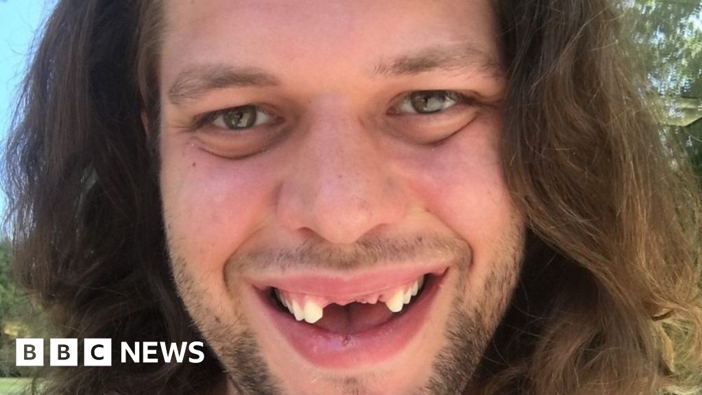 The opera singer who wants his front teeth for Christmas