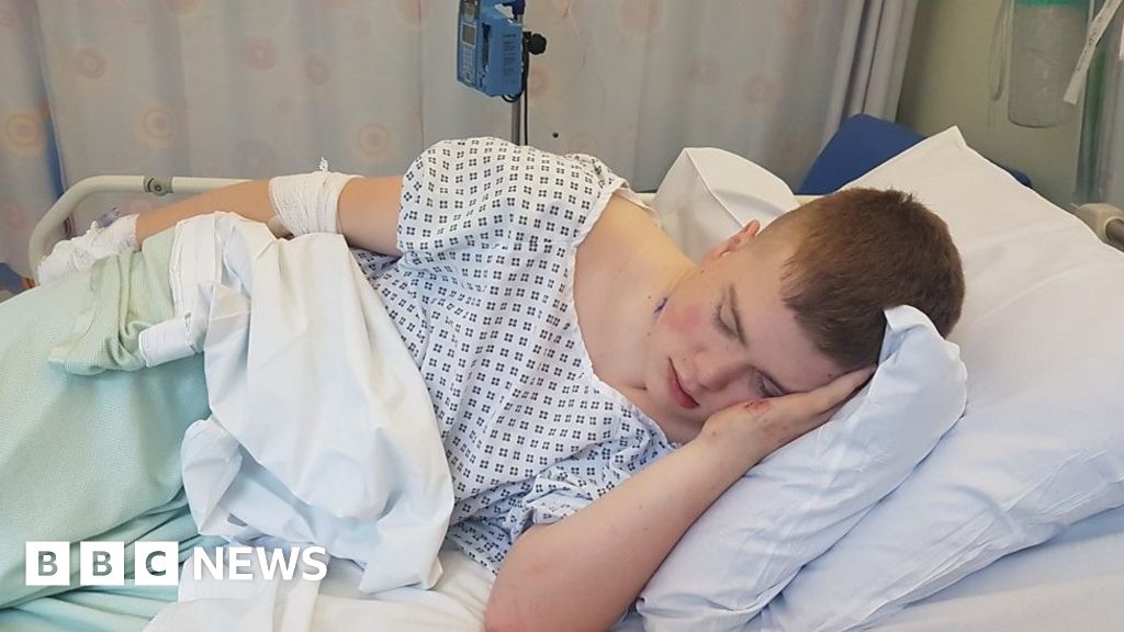 Teenager left with broken jaw after Newcastle match