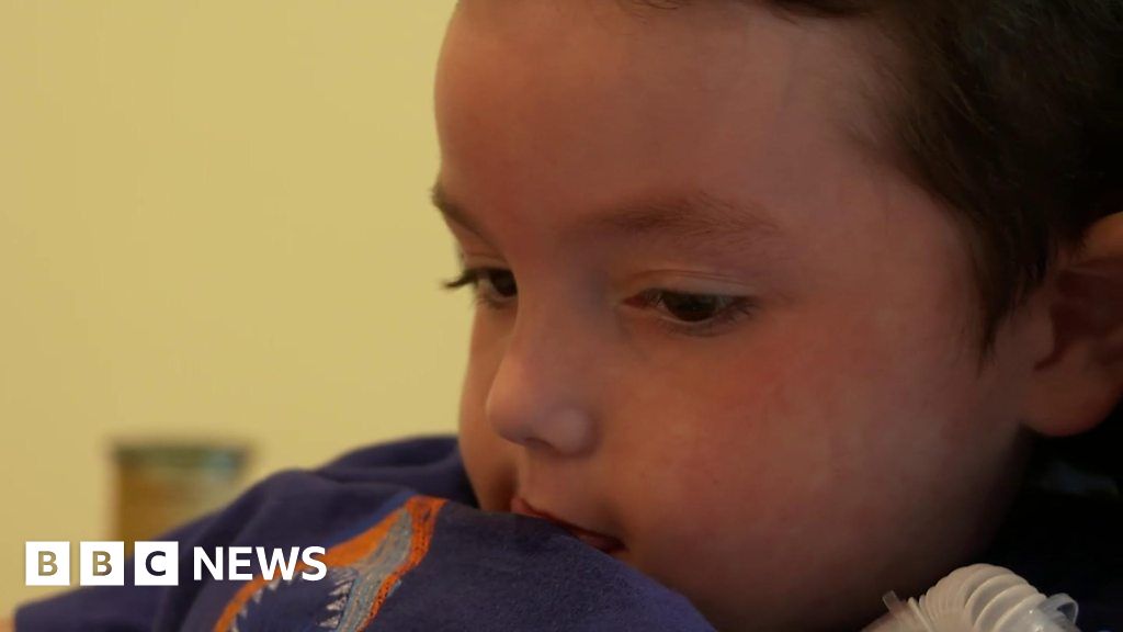 The US boy who outlived medical expectations