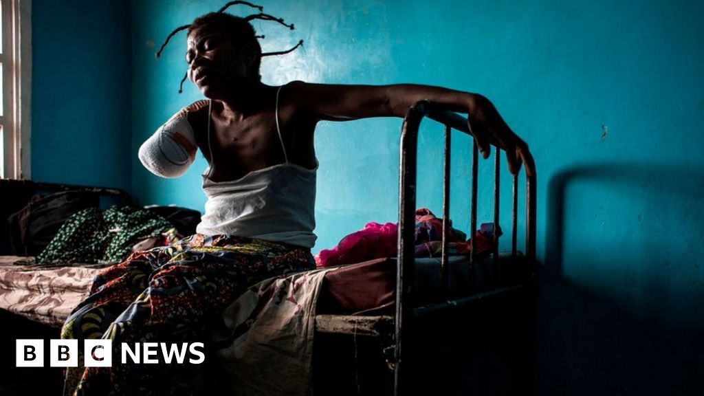 Surviving Congo's massacres: 'I climbed over bodies to flee' - BBC News