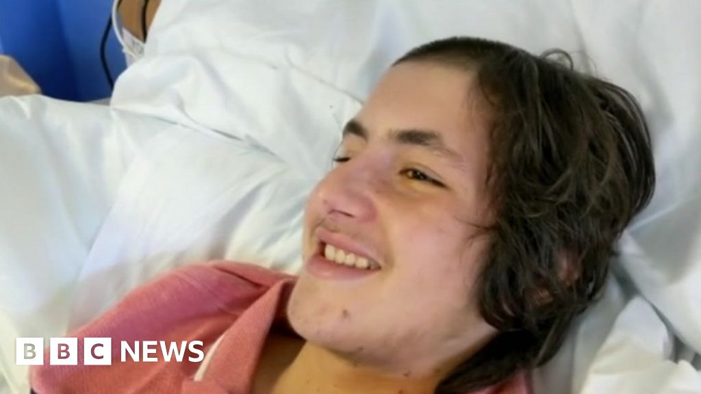 Skater with 'catastrophic' head injury back home - BBC News