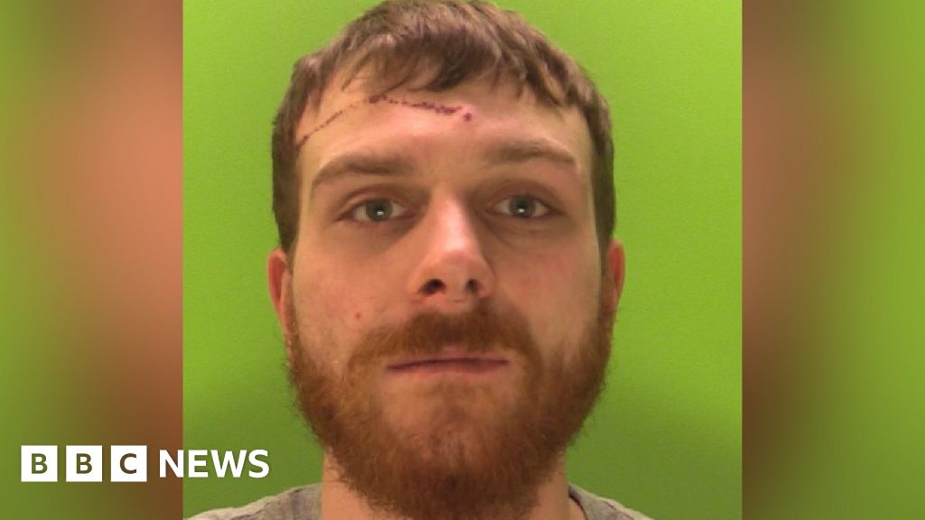 Man Jailed For Attack That Left Nottinghamshire Pcs Skull Exposed