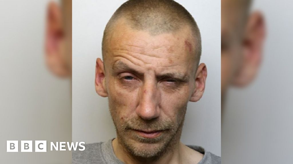 Man Jailed For Slashing Derby Police Officers Face With Knife Bbc News