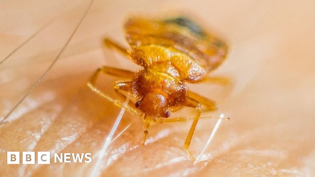 Bed bugs found in King's College Hospital postnatal ward - BBC News