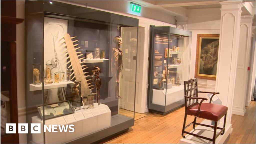 Edinburgh's Surgeons' Hall Museums reopens after £4m revamp - BBC News