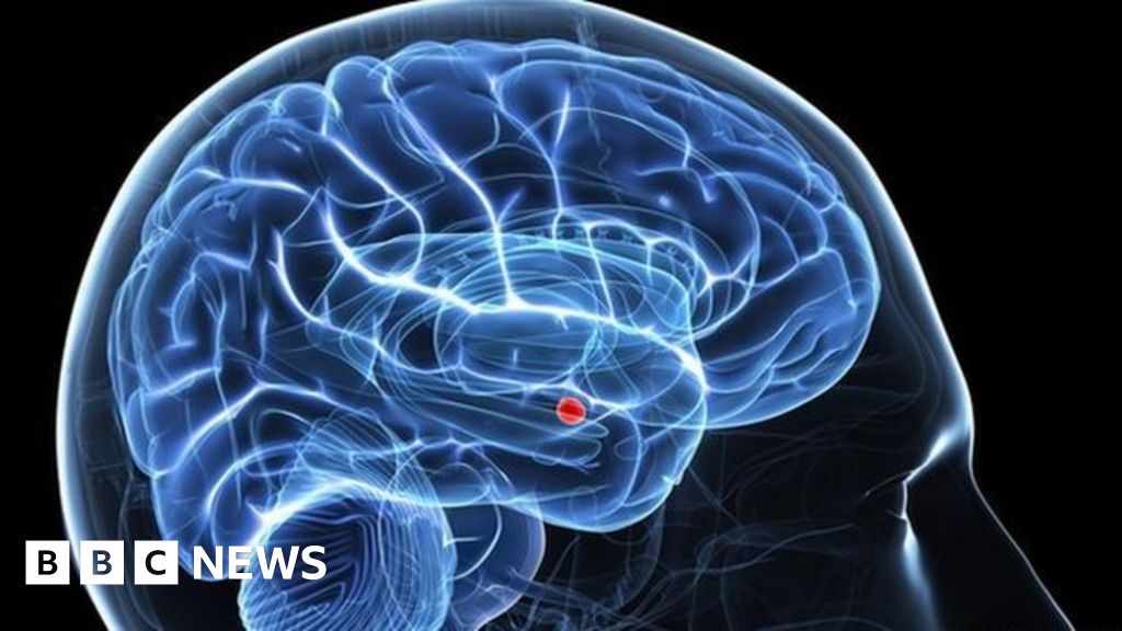 Cardiff psychologists develop autism self-assessment test - BBC News