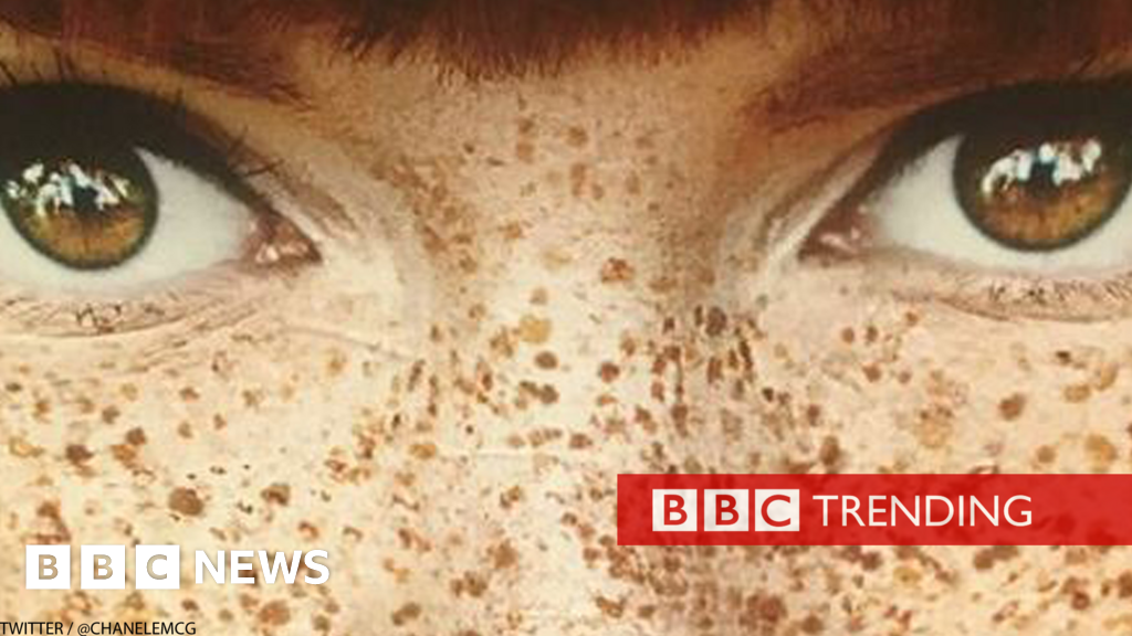 Why freckles aren't 'imperfections', and more trends of the week - BBC News