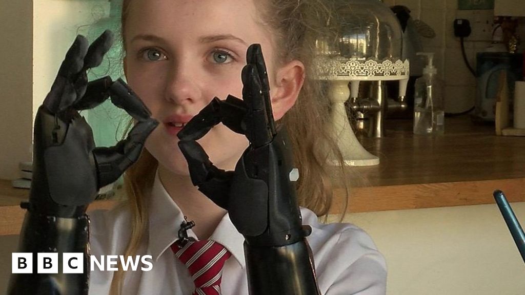 Meningitis Survivor Tilly Lockey Gets Bionic Hands Bbc News