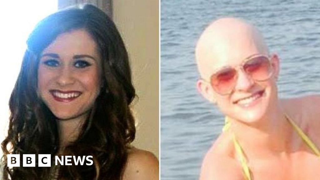 Student Imogen Proctor speaks of alopecia hair loss shock - BBC News