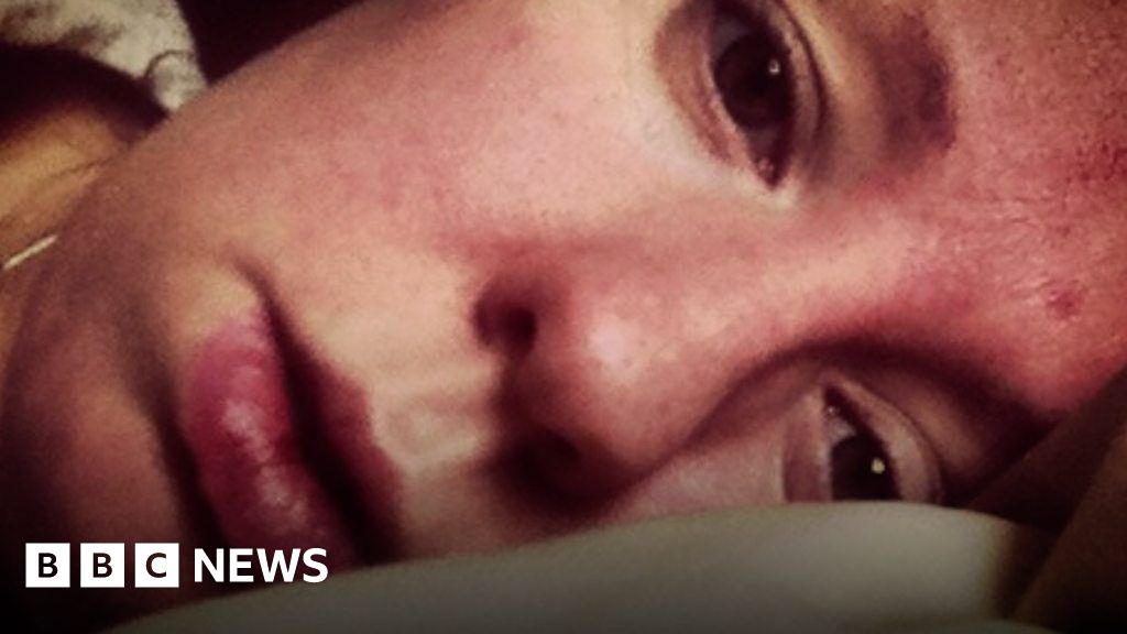 'It felt like my whole body was being poisoned'