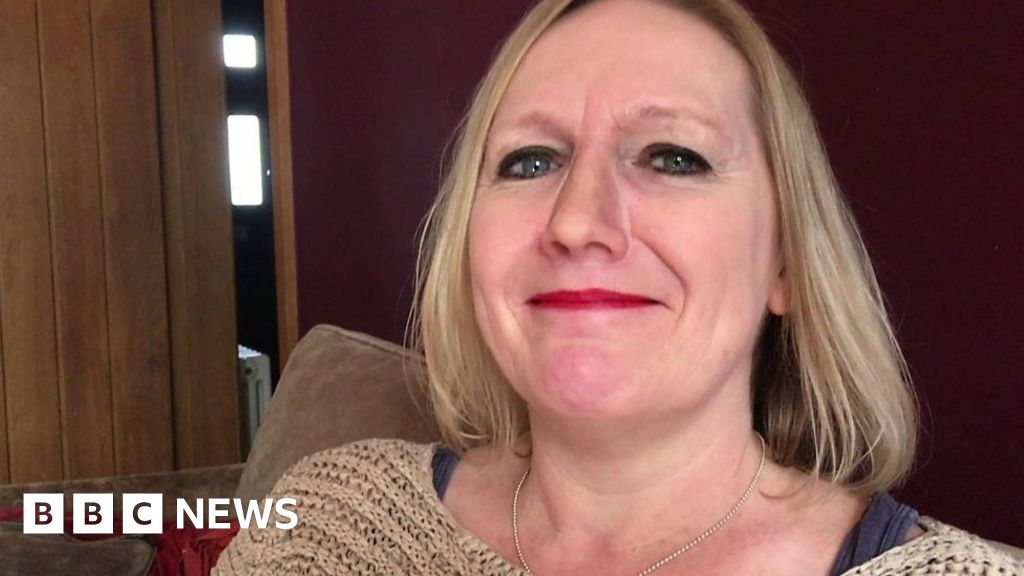 Prosthetic nose 'has changed my life' - BBC News