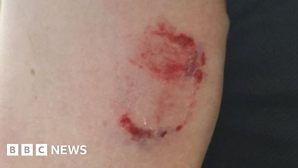 West Midlands Police officer bitten during New Year's Day attack - BBC News