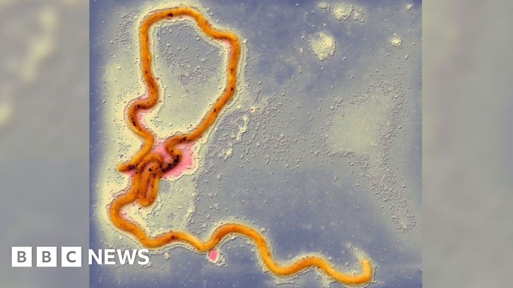 Syphilis patient calls for public debate as cases rise
