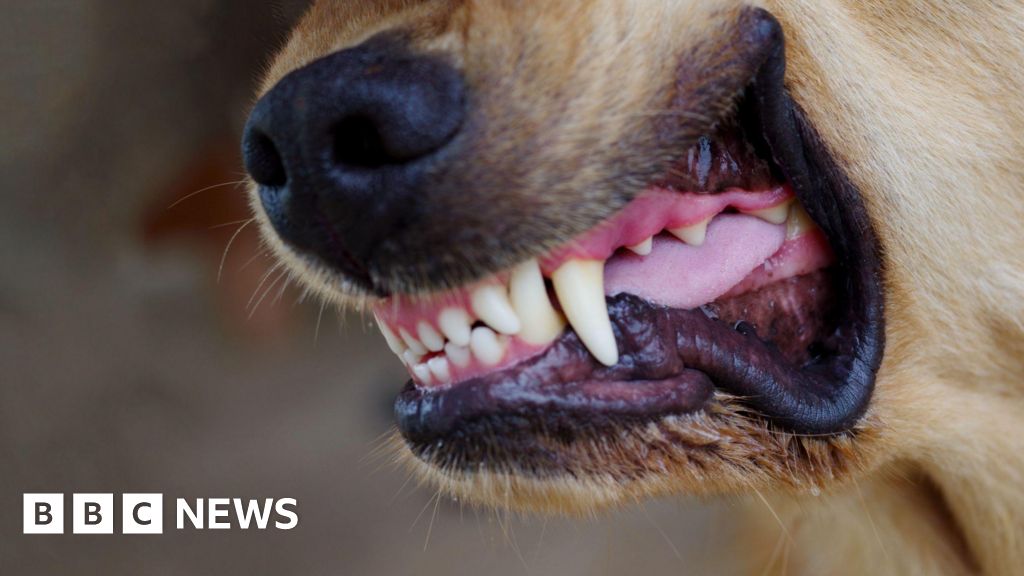 'Worrying rise in dog attacks on children', says Sussex surgeon