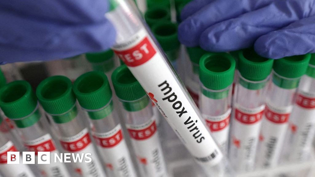 NHS opens a further 12 mpox vaccination centres in England