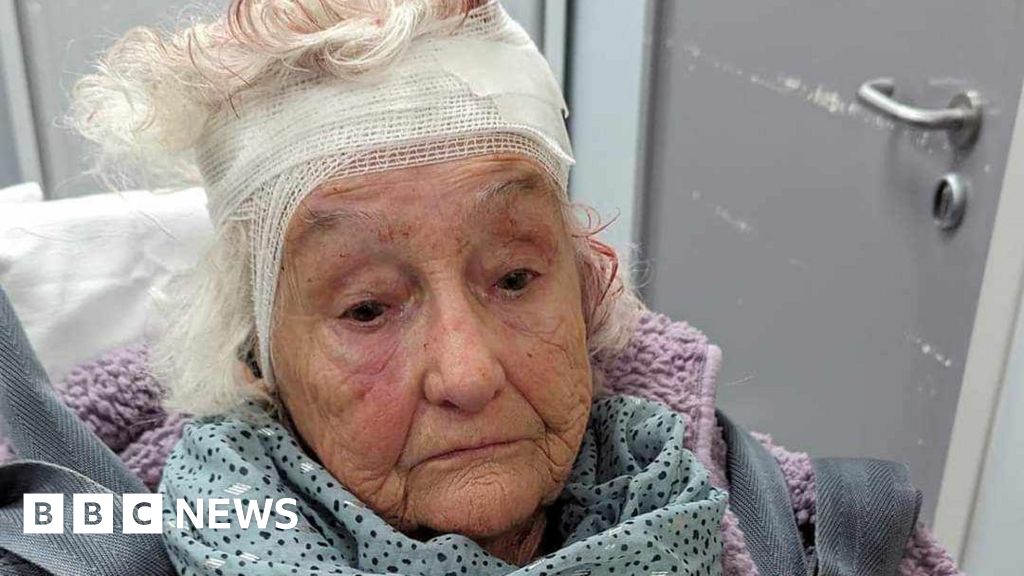 Pavement fix plea after woman's mobility scooter crash