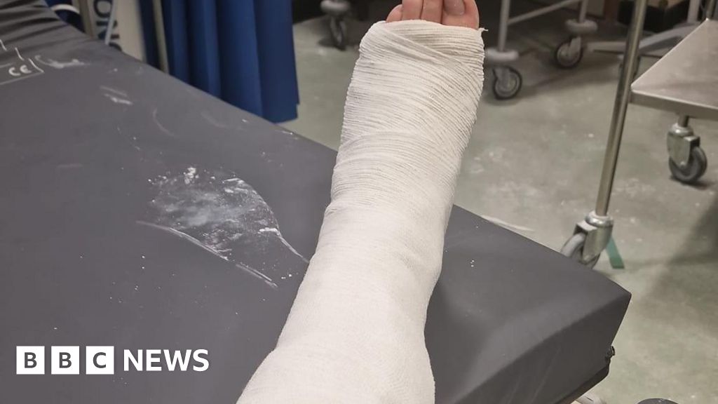 Special constable's leg broken in 'unacceptable' Plymouth assault