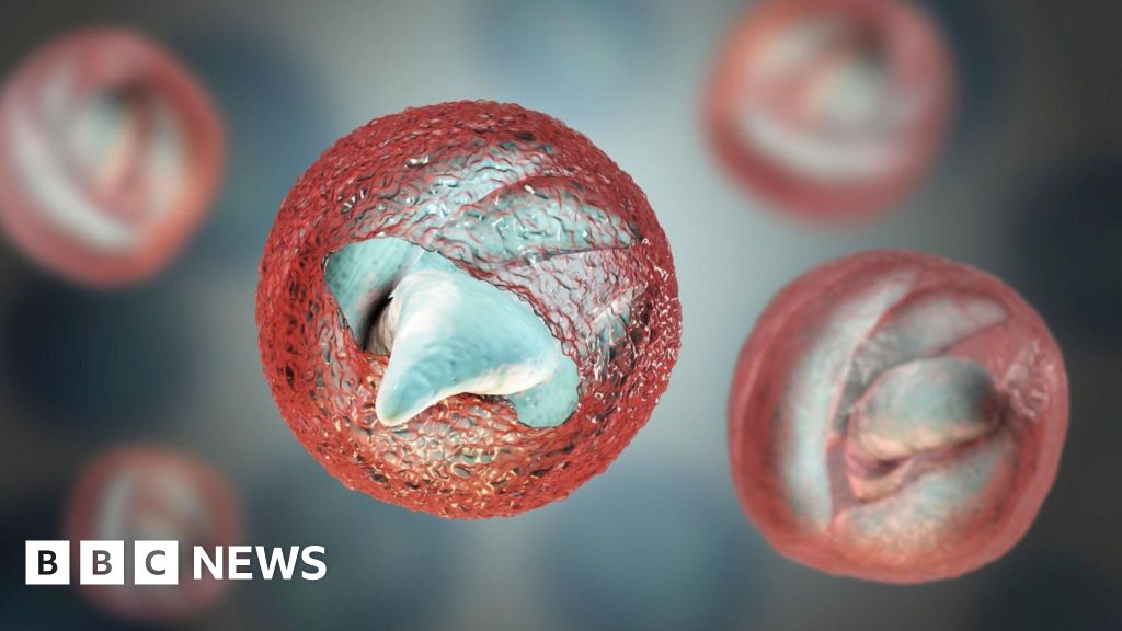 Cryptosporidium: Water parasite found in salad bags sold in Kent