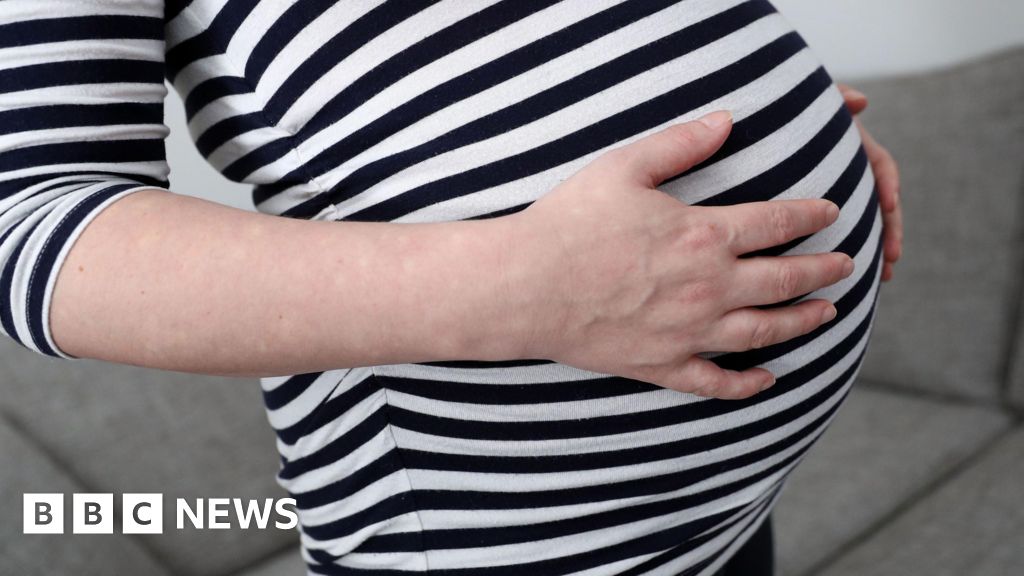 Concern over lack of data on elective C-sections in Guernsey