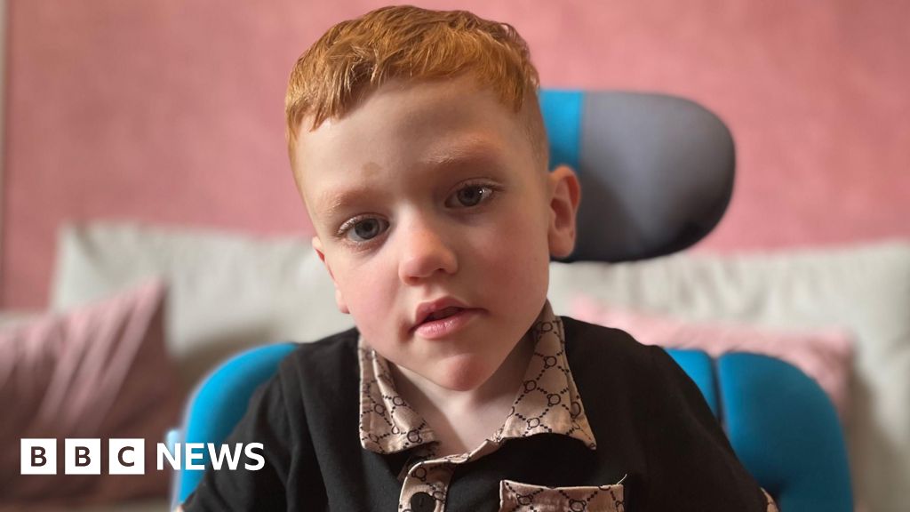 'My son has a rare condition only 15 people have'
