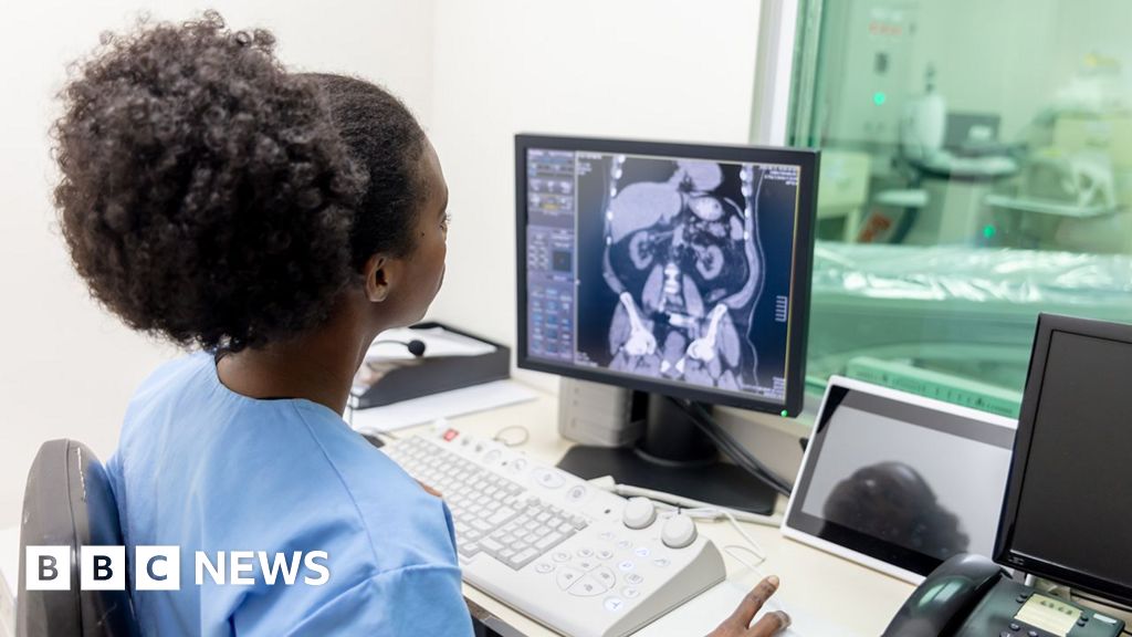 Cancers getting diagnosed at earlier stages