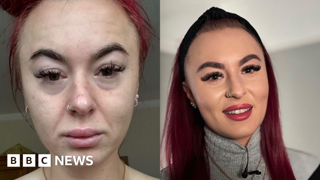 Ketamine addict warns of drug's impact on users - BBC News