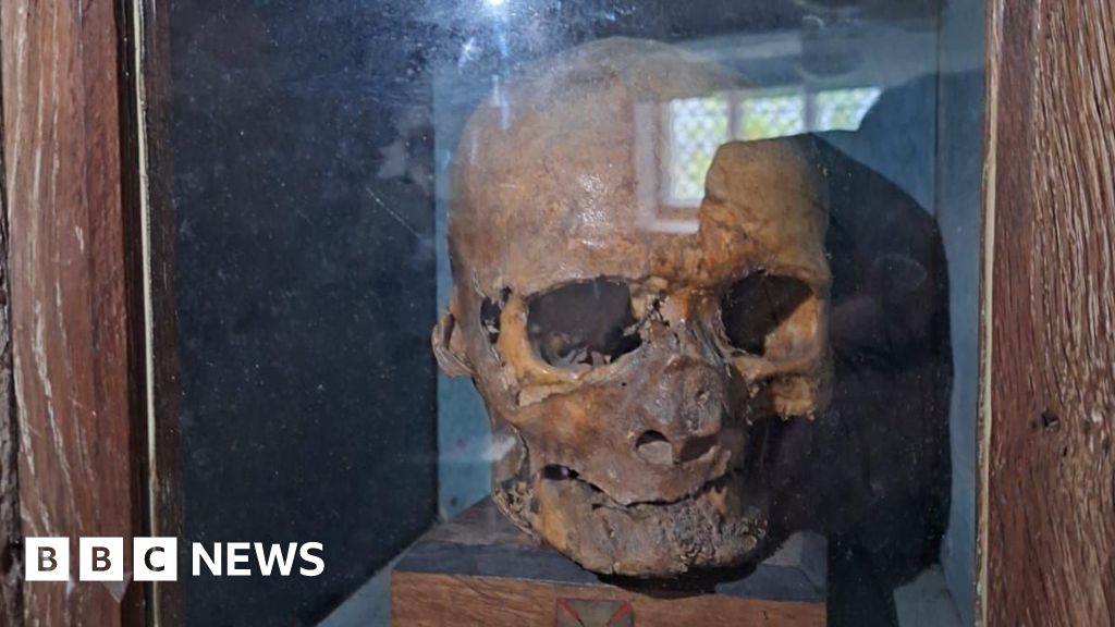 Why an archbishop's severed head is stored in a church in Suffolk