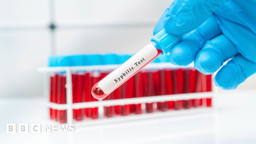 Sexual health services recommissioned across Cambridgeshire