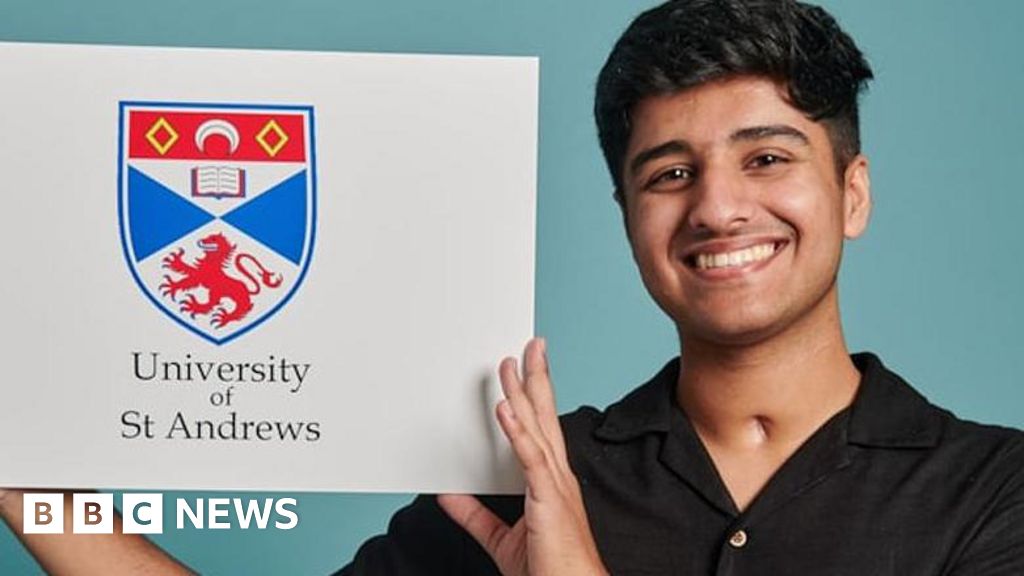 Burnley: Student who was in coma now training to be doctor