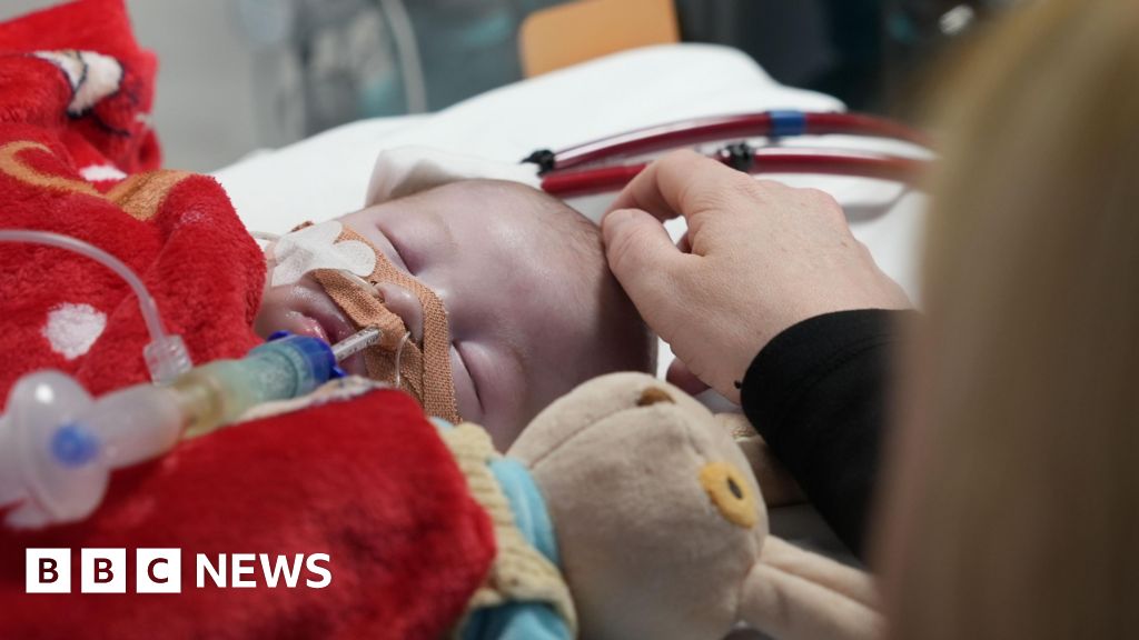 Billingham baby fighting for life as he waits for heart donor