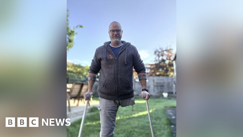 'Leg amputation after cancer diagnosis gave me my life back'