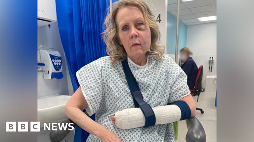 Leighton Buzzard woman's legal action after bollard trip