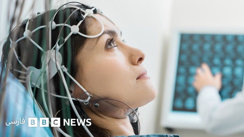 تحریک مغزی باعث تقویت حافظه برای یک ماه شد Bbc News فارسی